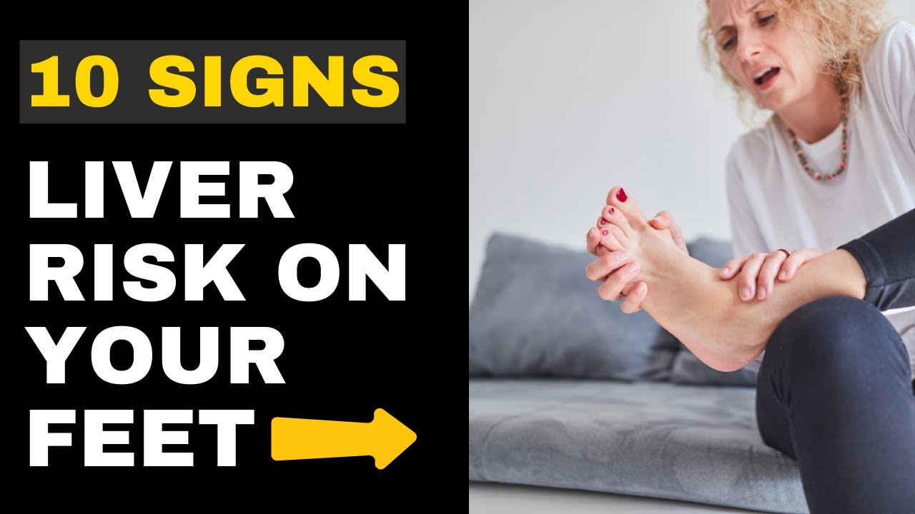 Are Your Feet Warning You of Liver Problems? Healthy Life - YouTube
