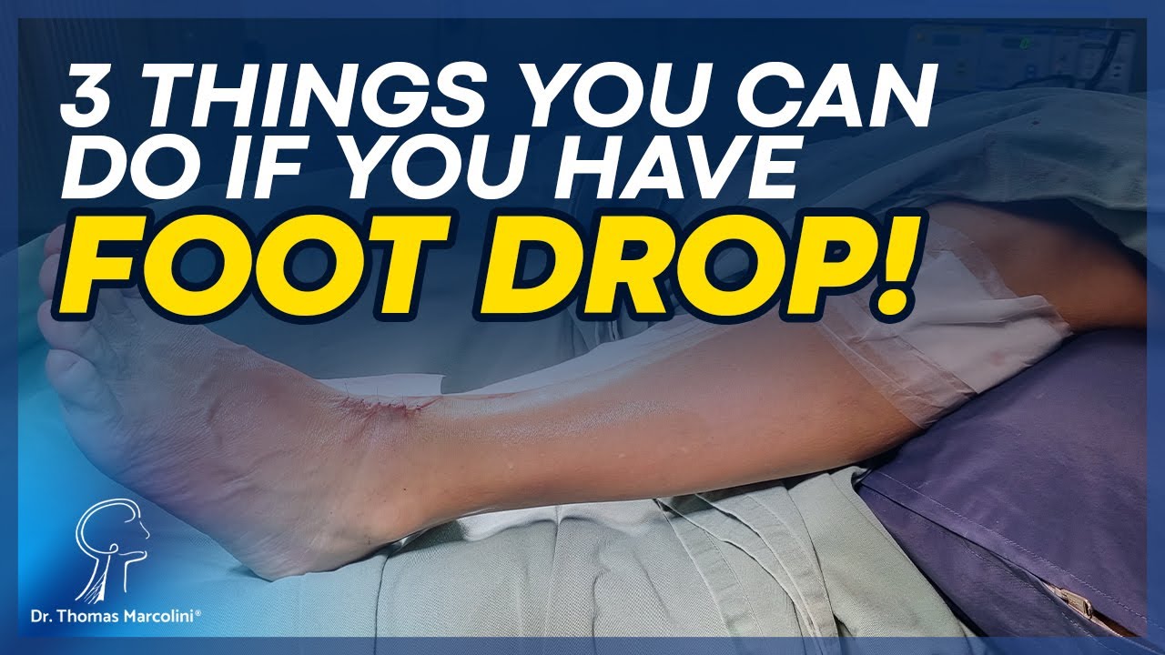 Foot Drop Surgery: When is it Done, What are the Indications? Restoring ...