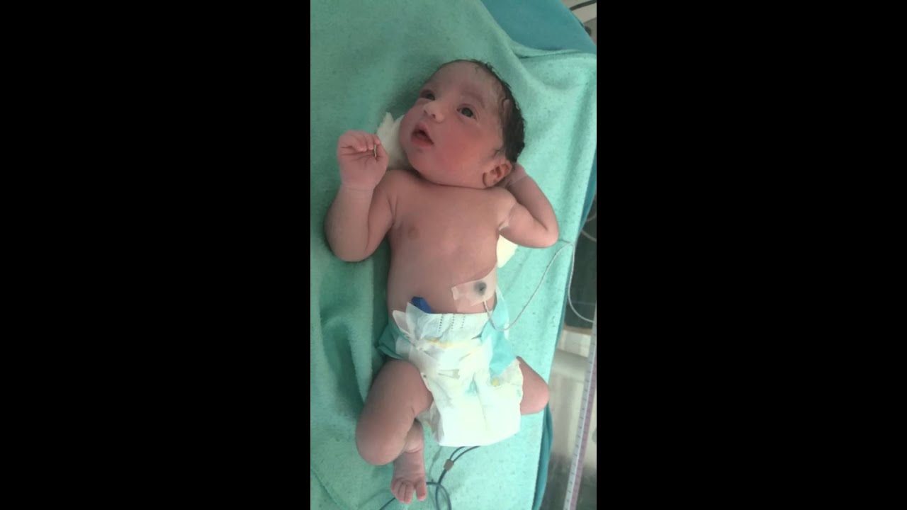 New born baby (20 mintues old) moving legs and hands - YouTube
