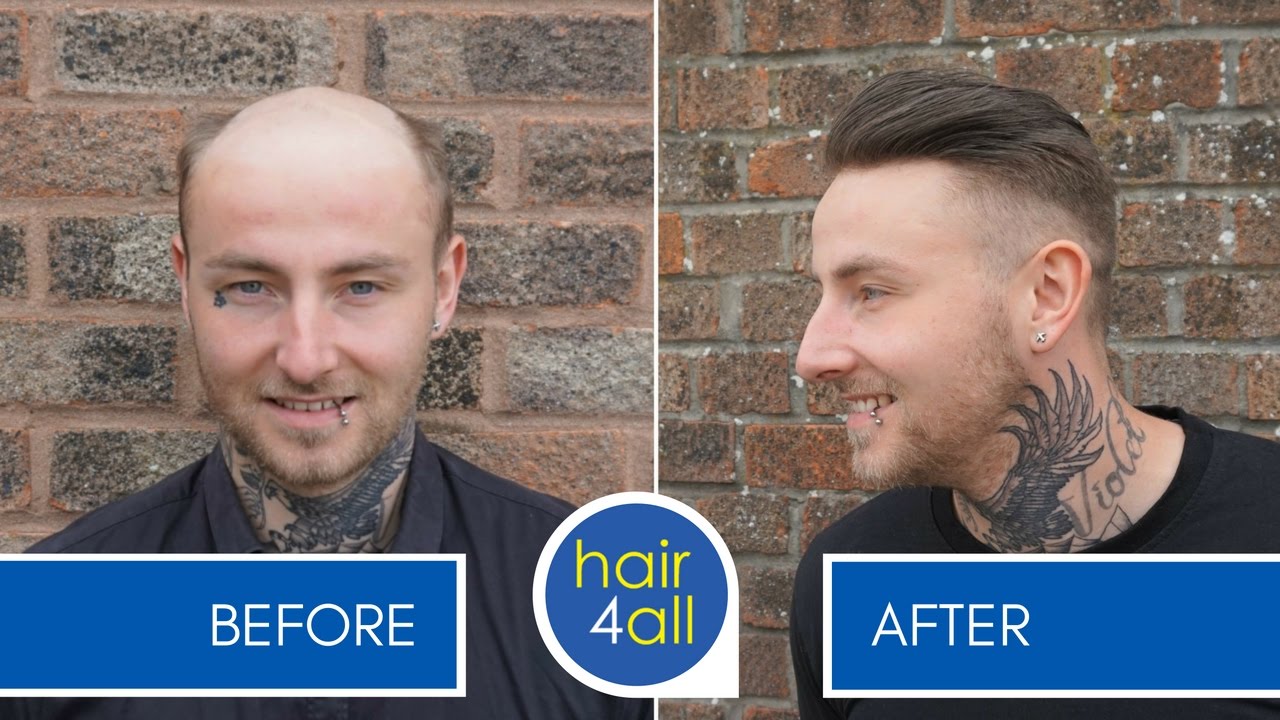 How to Apply (Attach) a Non-Surgical Hair Replacement System for Men ...