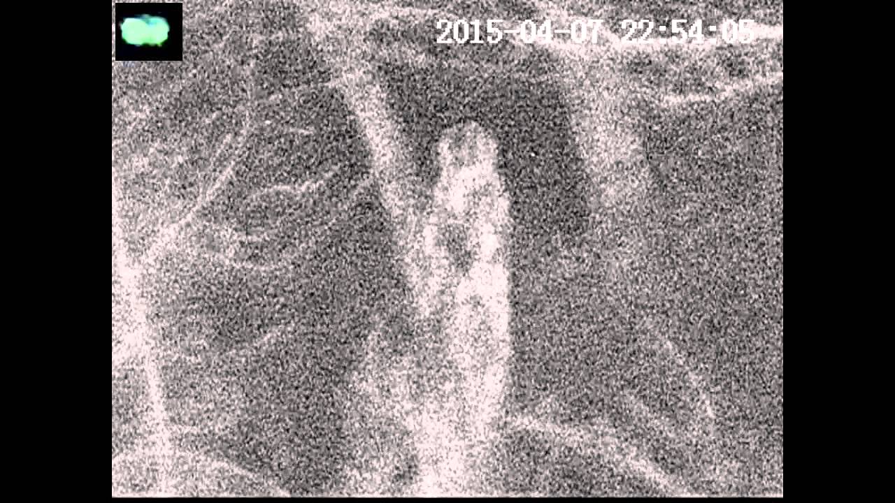 Real Shadow People Watching Watching Me. - YouTube