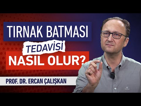 Tırnak Batması Tedavisi Nasıl Olur | Prof. Dr. Ercan Çalışkan
