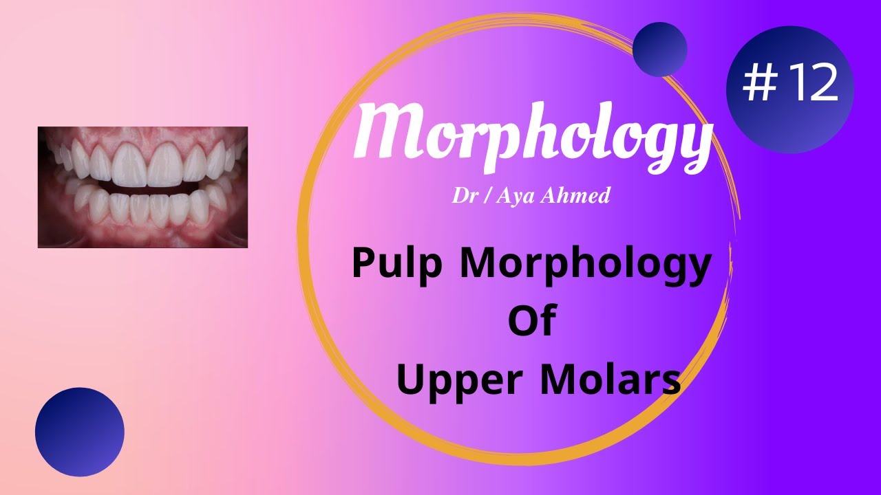 Morphology - #12 - Pulp Morphology Of Upper Molars - YouTube
