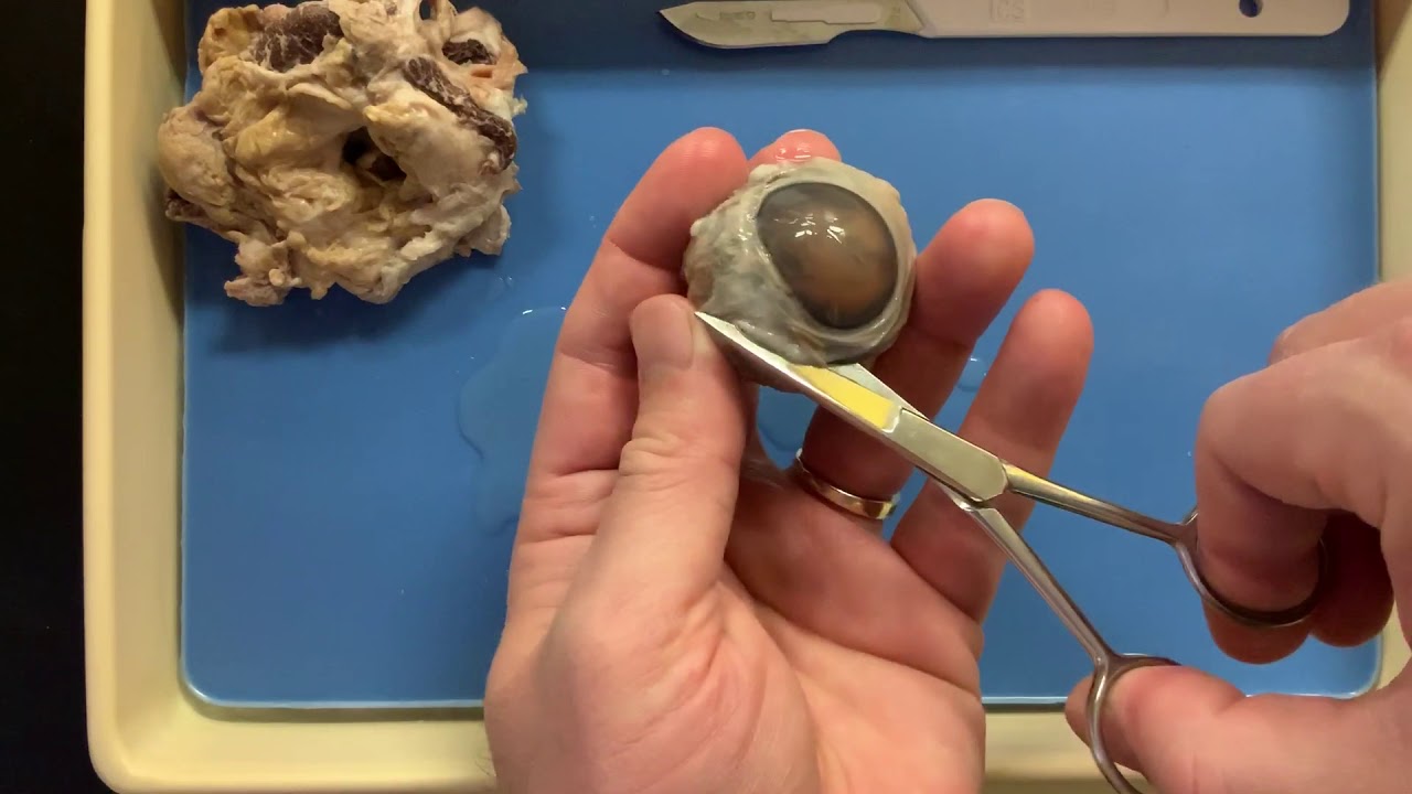 Cow’s Eye Dissection - YouTube