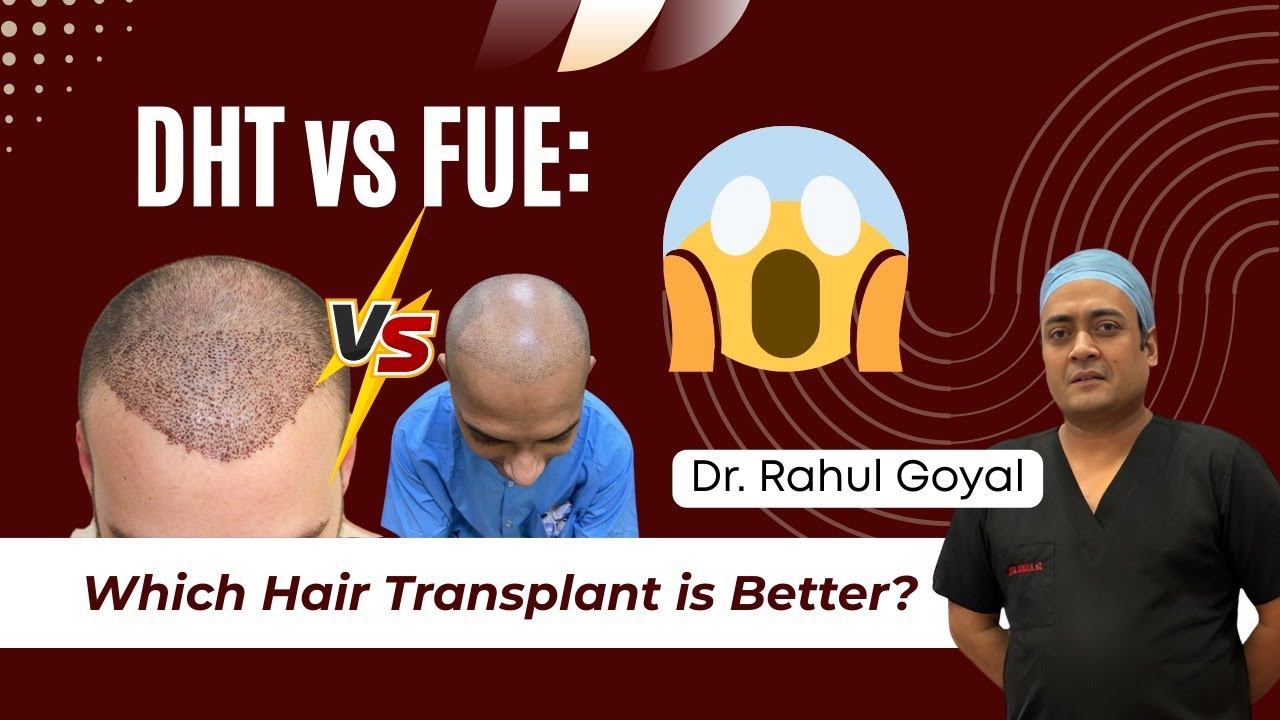 "DHT vs FUE: Explained by Dr. Rahul Royal – Which Hair Transplant ...