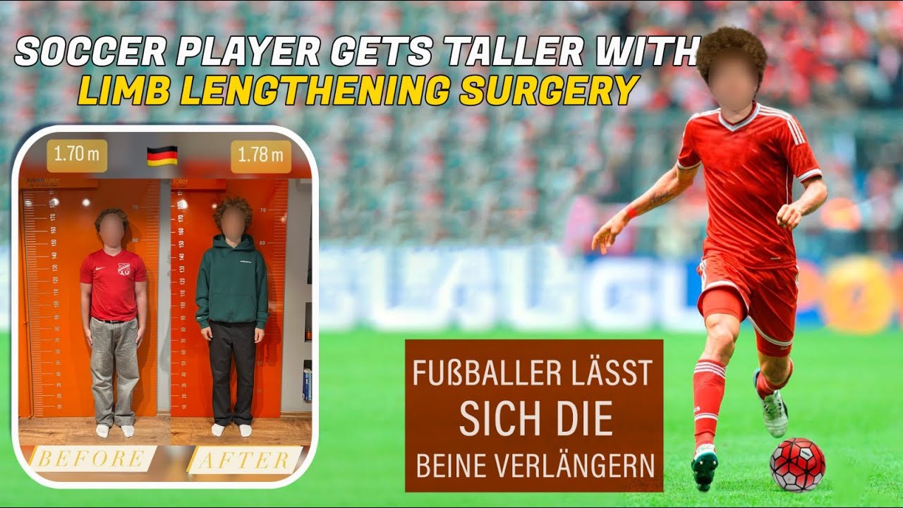 Soccer Player Gets Taller with Limb Lengthening Surgery | Fußballer ...