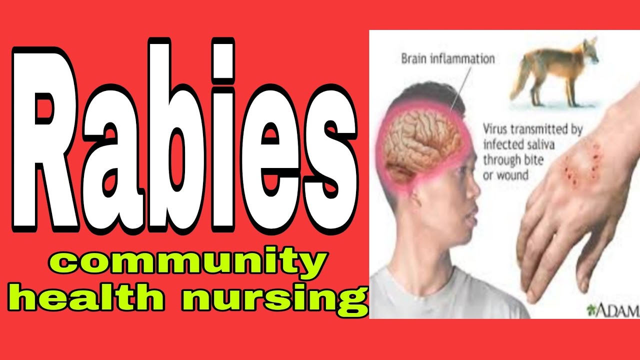 Rabies / hydrophobia / community health nursing - YouTube