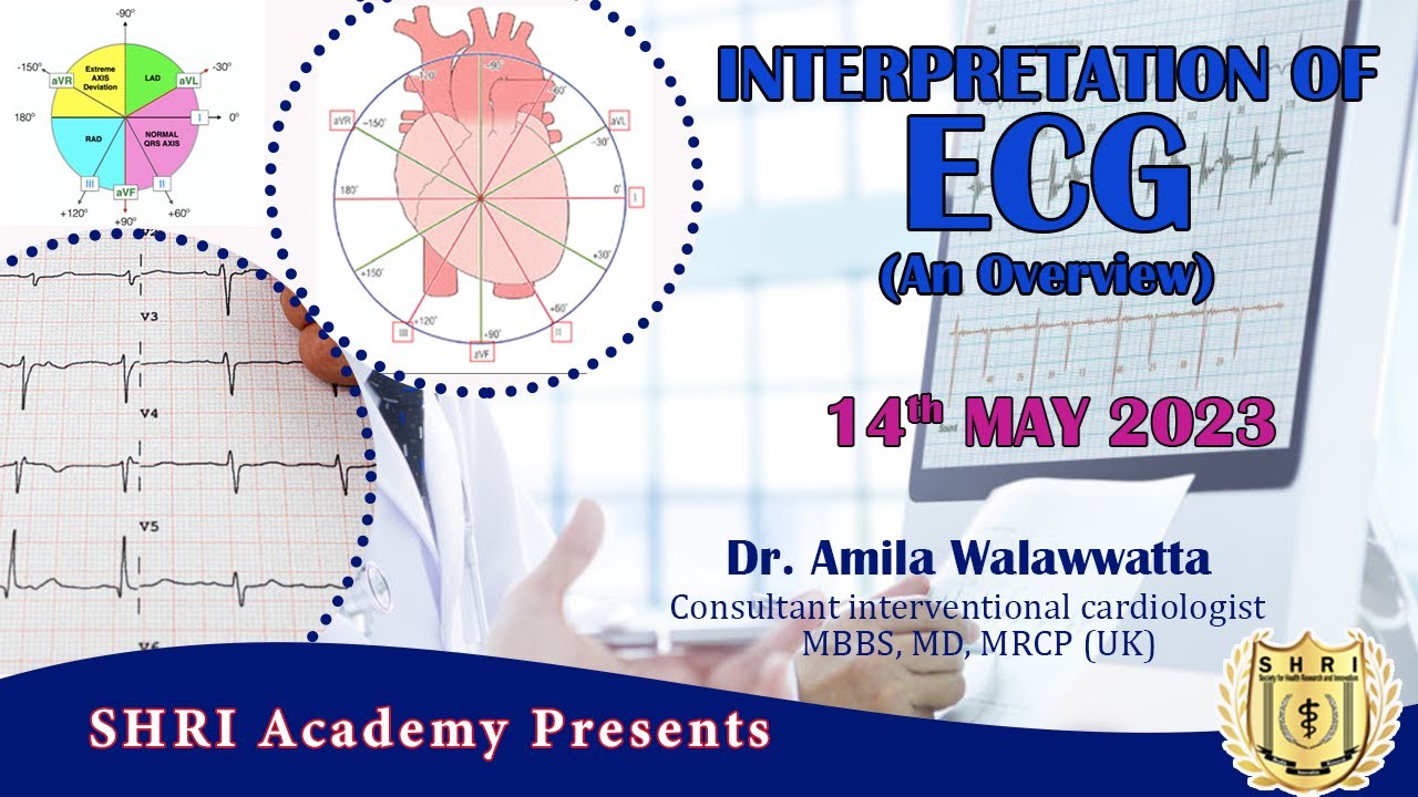 INTERPRETATION OF ECG (An overview) - YouTube