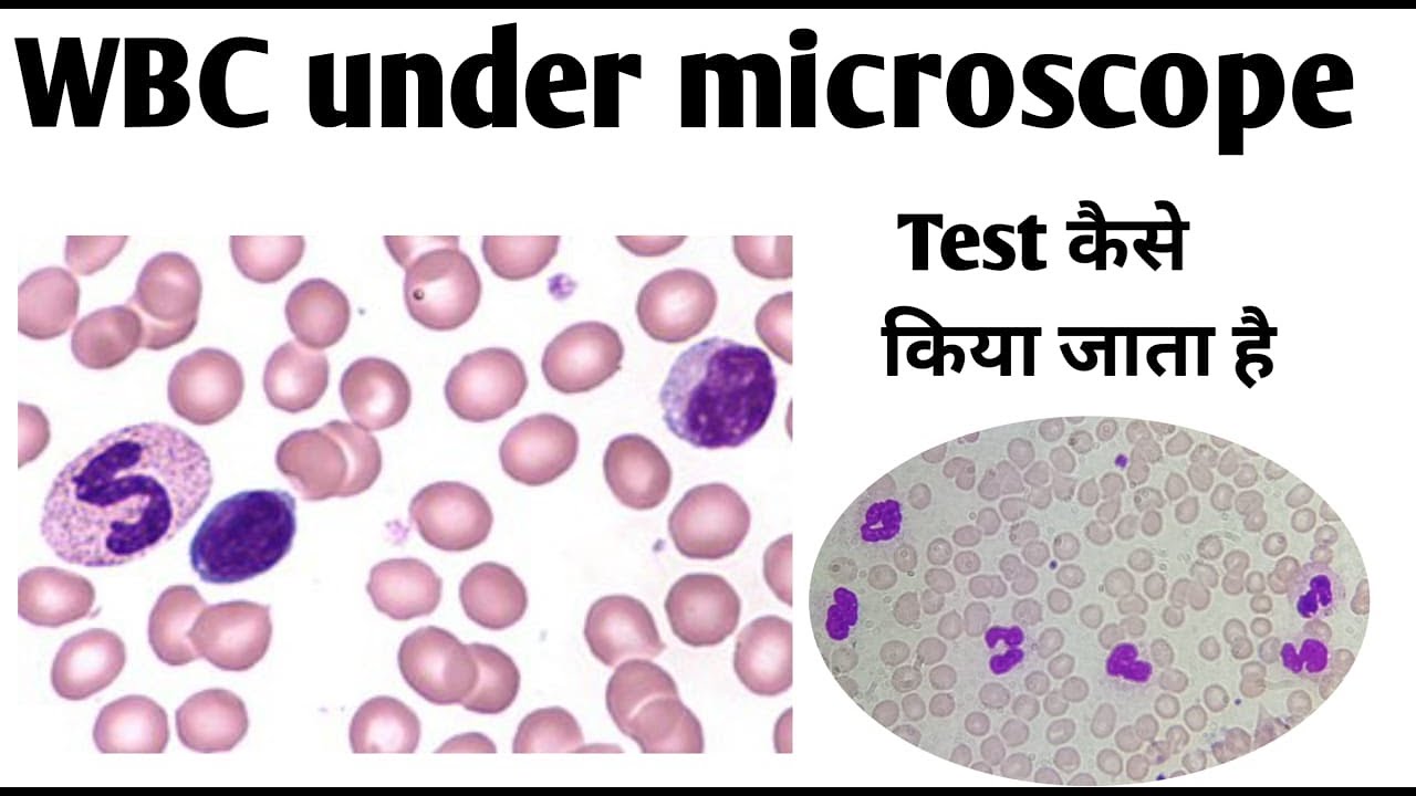 wbc under microscope - YouTube