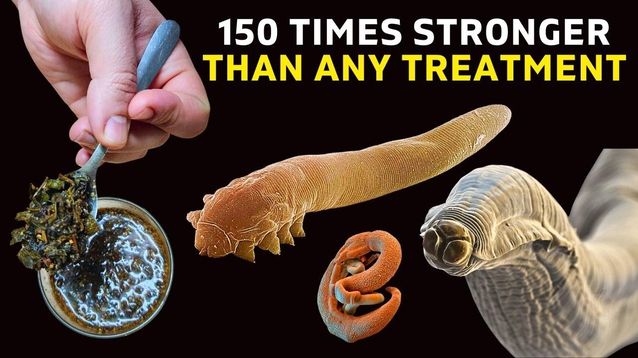 The body itself will spit out the dead parasites! parasites in humans ...