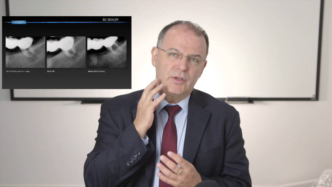 BioCeramic Sealer's Intracanal Medication Effect! (Dr. Alex Fleury ...
