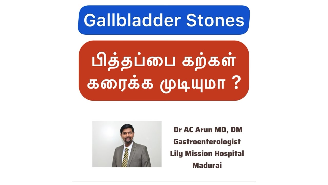 Dr AC Arun - பித்தப்பை கற்கள் - Gallbladder stones Treatment Tamil ...
