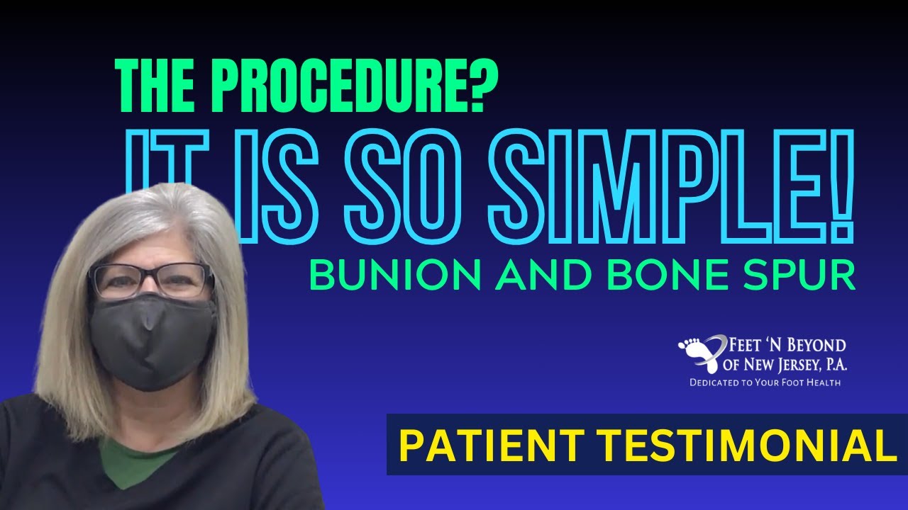 Bunion and Bone Spur Pain Relief: Real Testimonial and Solution - YouTube