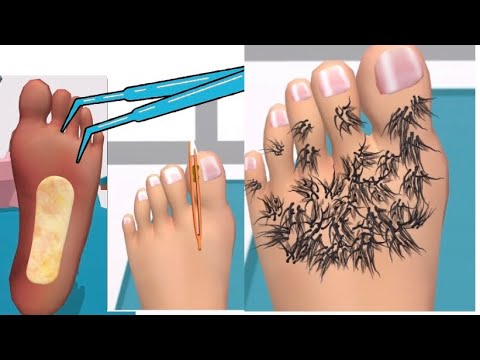 ASMR Foot cleaning | pedicure #footcare #footclinic #animation #hygiene ...