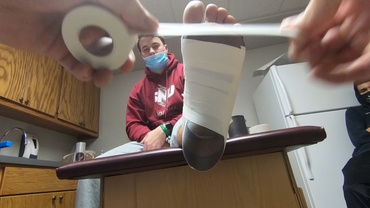 Transverse Arch Taping Plantar View - YouTube