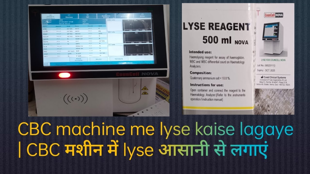 CBC machine me lyse kaise lagaye | CBC machine me lyse kaise change ...