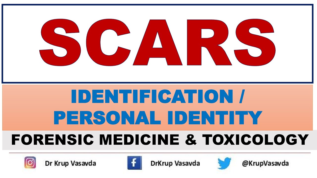 Scars | Identification | Dr Krup Vasavda - YouTube