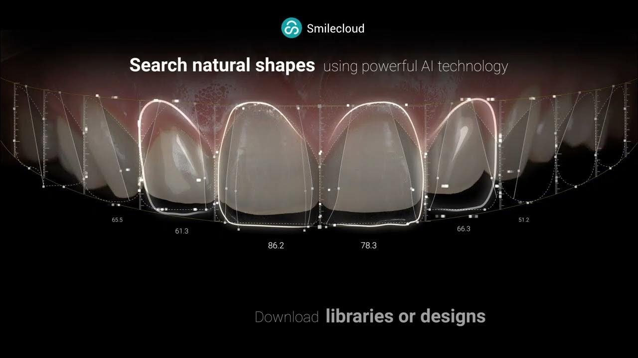 AI Smile Design - YouTube
