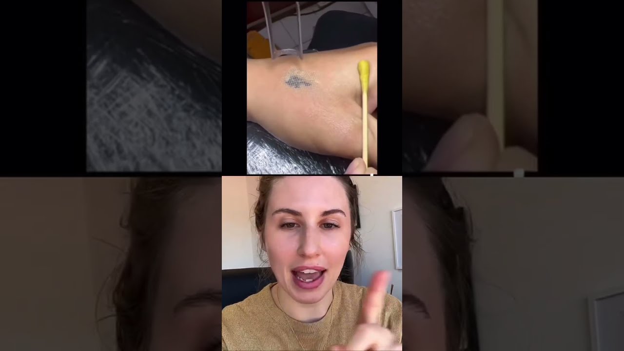 Zapping Tattoos…How Laser Tattoo Removal Works! - YouTube