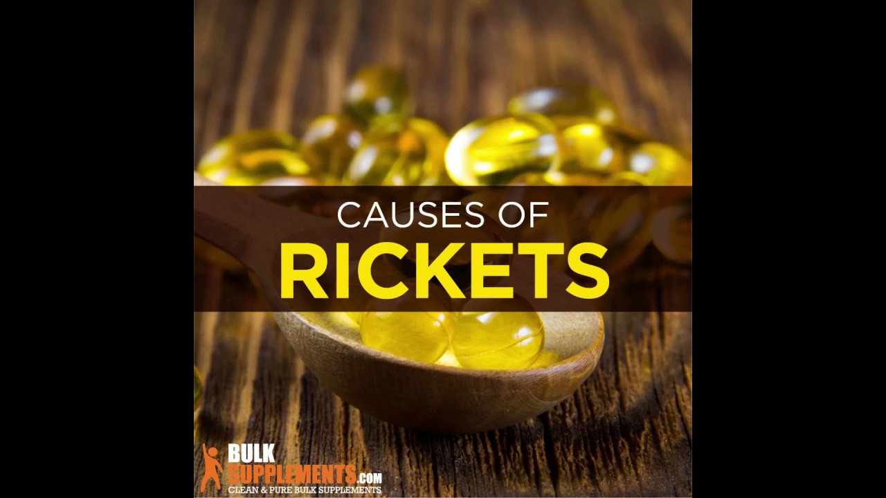What is rickets - rickets disease - what are rickets - what causes ...