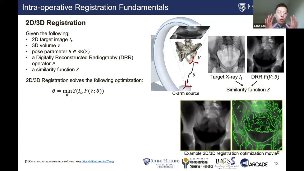 MAIB-Talk-013: A SyntheX - Realistic Synthesis for X-ray Image Analysis ...