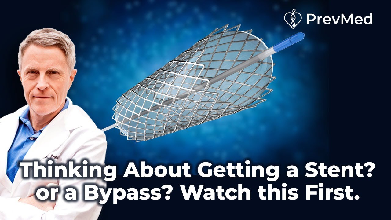 Thinking About Getting a Stent? or a Bypass? Watch this First. - YouTube