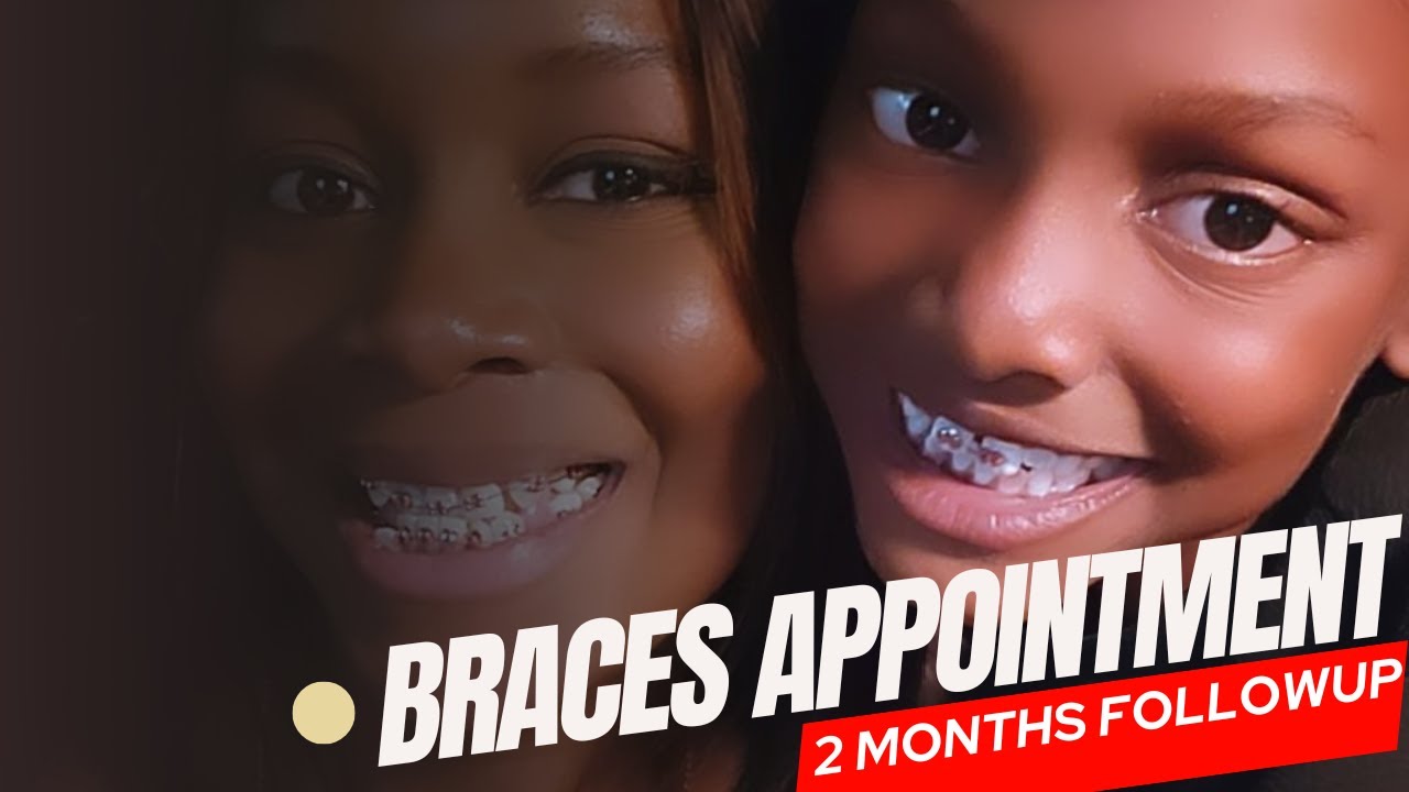 MY TWO MONTHS BRACES APPOINTMENT | COME WITH ME TO MY ORTHODONTIST APPT ...