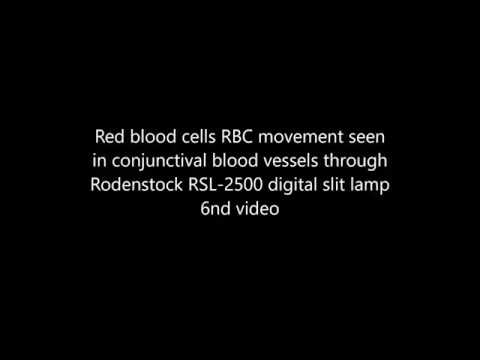RBC movement through Rodenstock RSL-2500 digital slit lamp - YouTube