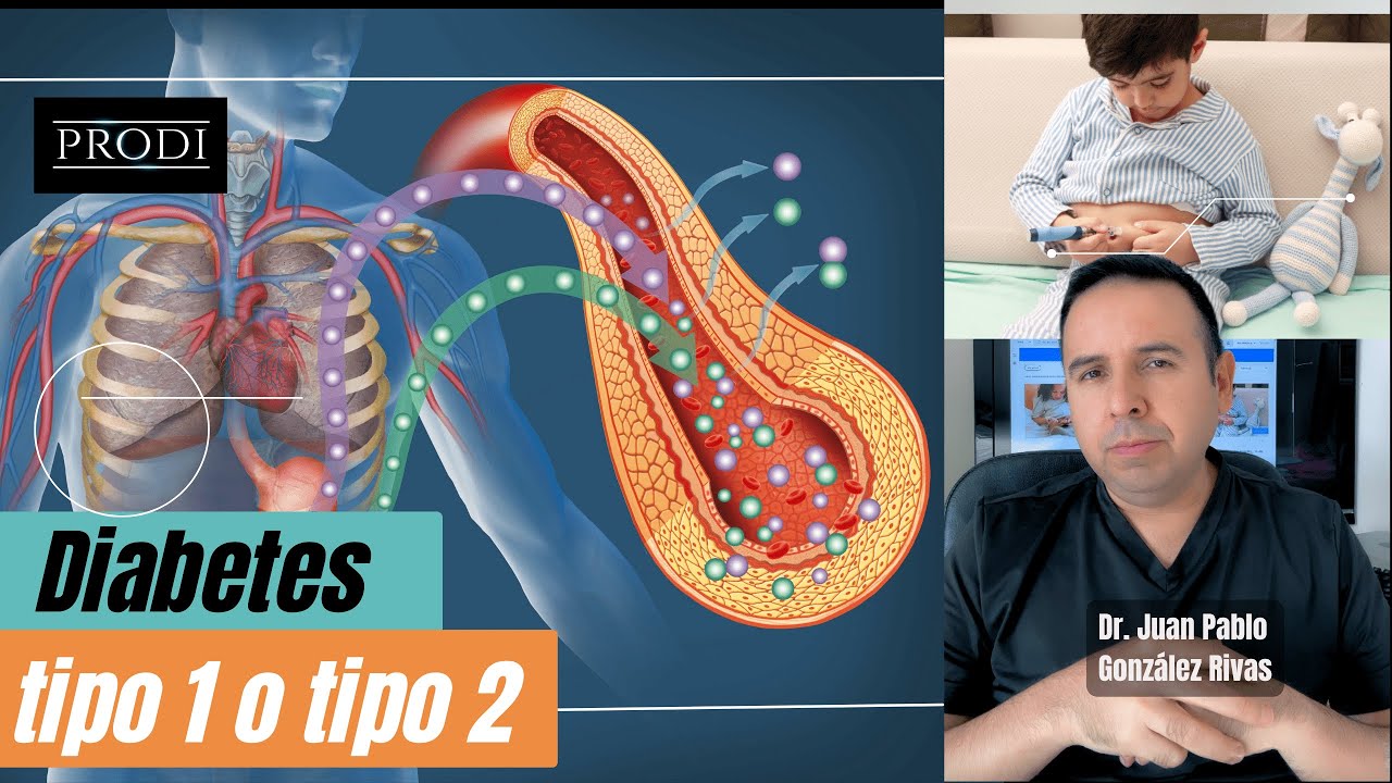 Diabetes tipo 1 o tipo 2. Conoce algunas diferencias - YouTube
