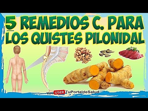 5 Remedios Caseros para el Quiste Pilonidal - Quiste Pilonidal Remedios ...