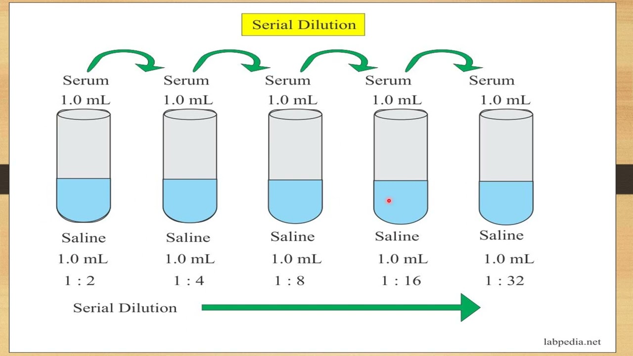Agglutinin Titer Determination - YouTube