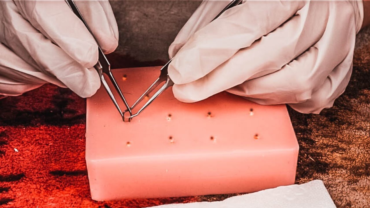 ASMR PIMPLE SURGERY! (popping) - YouTube