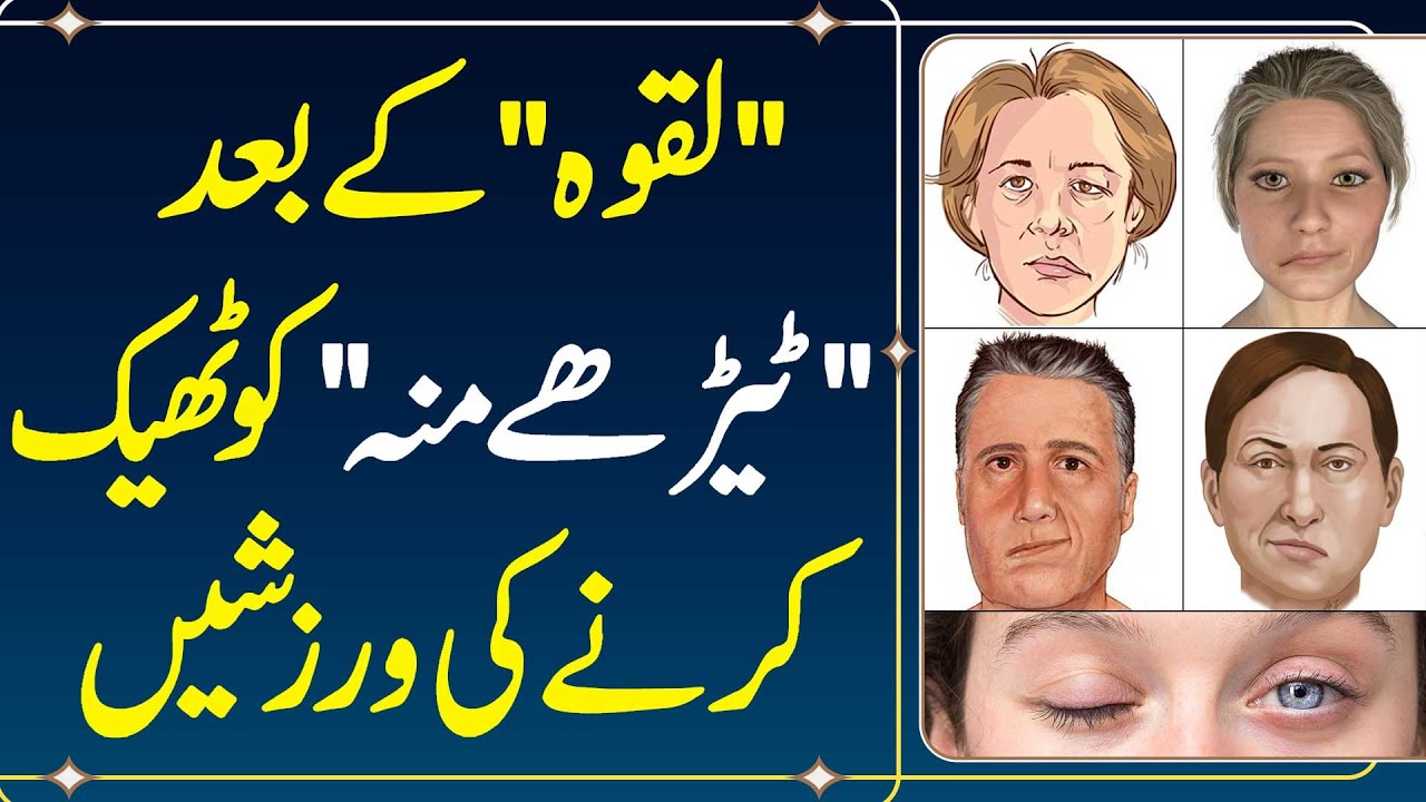 Lakwa Ke Bad "Kharab Face" Ko Kese Thek Kia Ja Sakta Hai - Watch ...