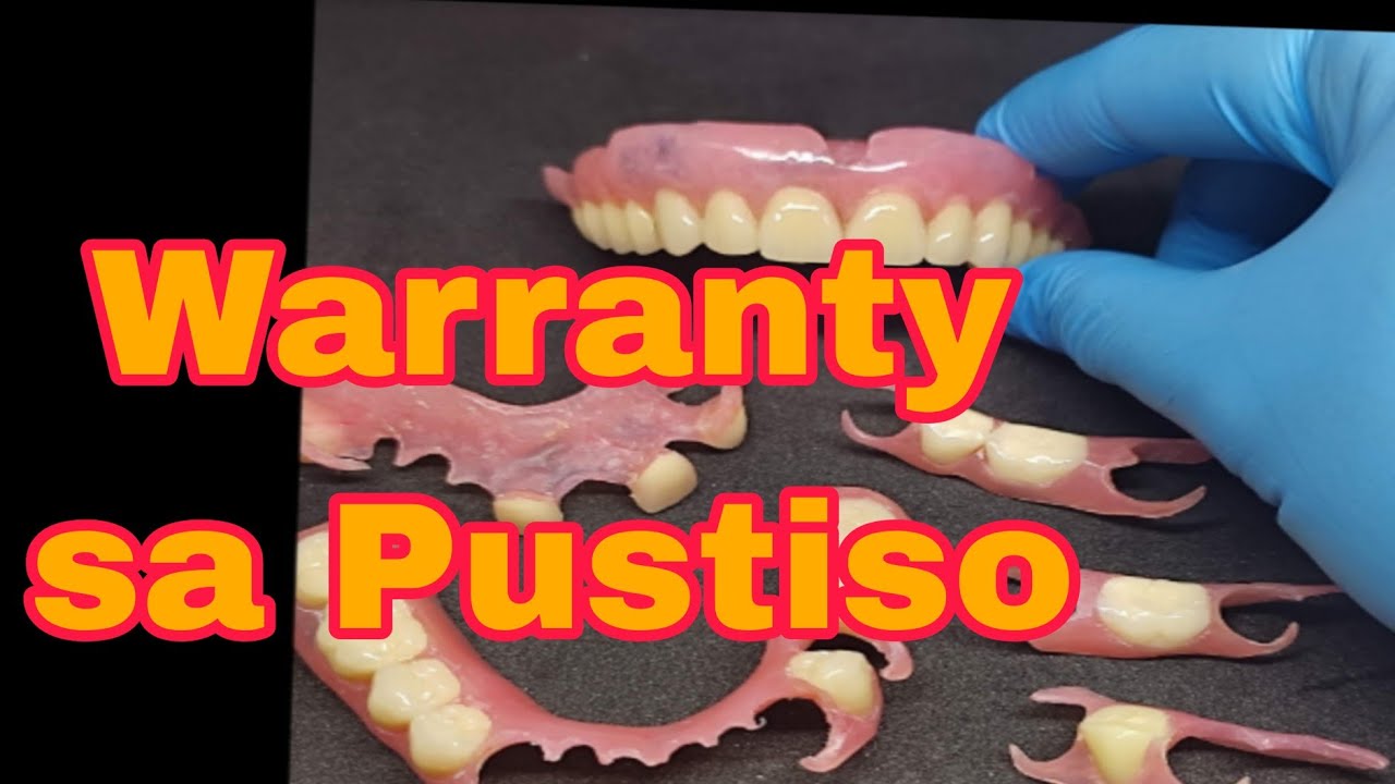 Pustiso/Denture Warranty Dapat Alam mo? - YouTube