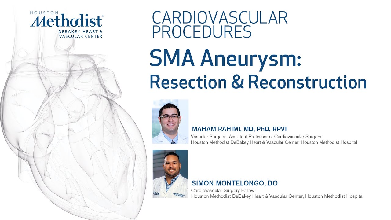 SMA Aneurysm: Resection & Reconstruction - YouTube