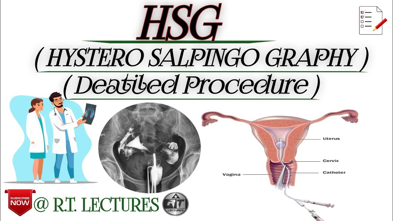 #HSG Procedure #Investigations of uterus & Fallopian tube # ...