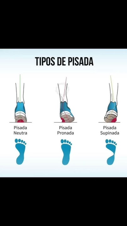 Tipos de pisada!!!! - YouTube