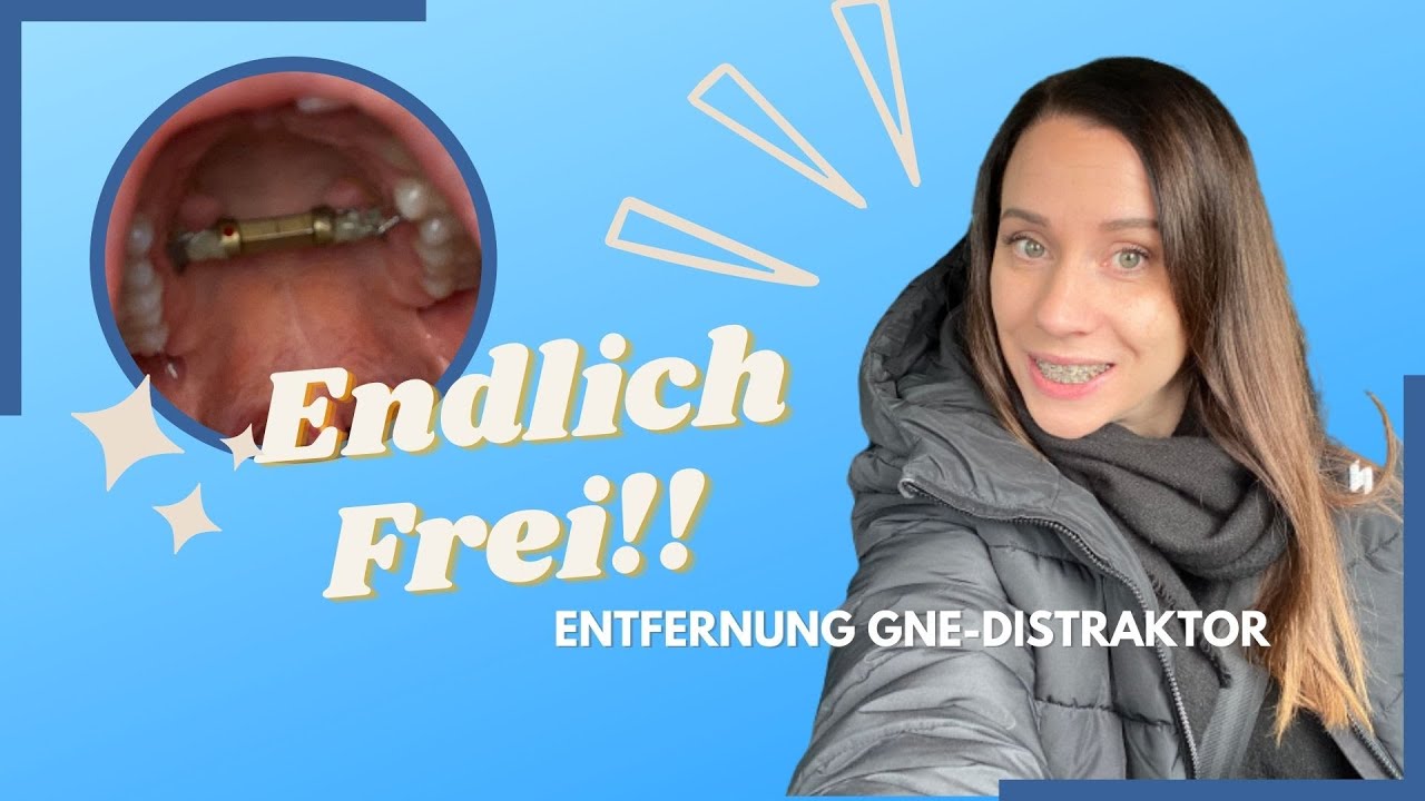GNE Entfernung. So war es bei mir!! - YouTube