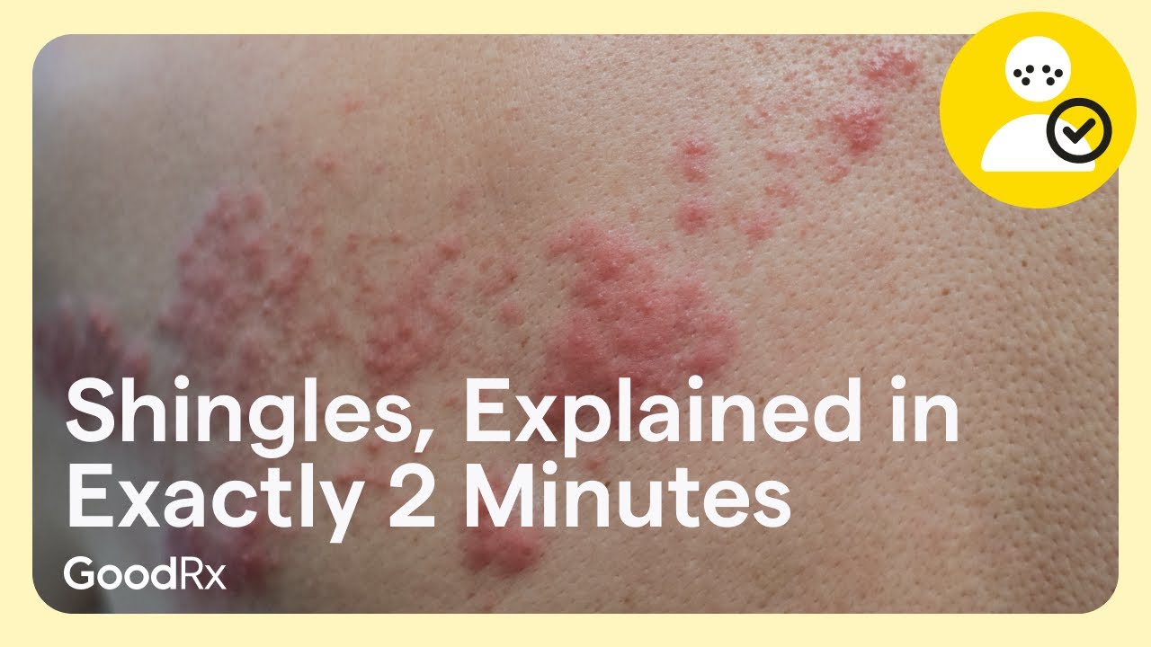 Shingles, Explained in Exactly 2 Minutes | GoodRx - YouTube