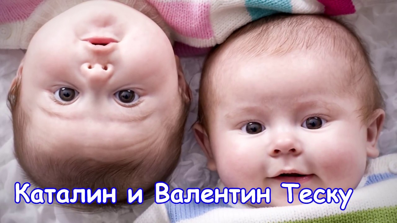10 невероятных близнецовНЕВЕРОЯТНЫХ БЛИЗНЕЦОВ Youtube