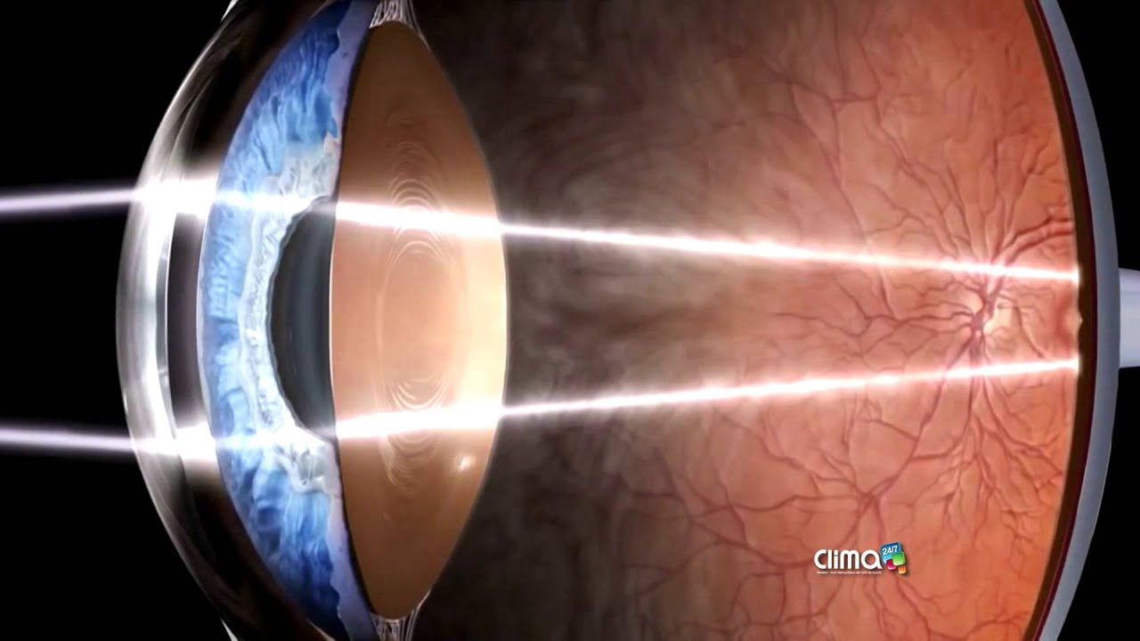 Medidas para proteger los ojos de los rayos UV - YouTube