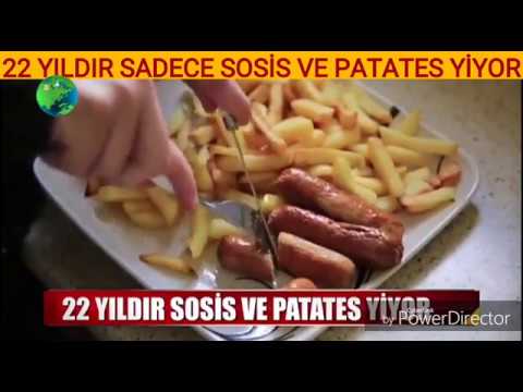 22 YILDIR SADECE SOSİS VE PATATES YİYOR (GERÇEK)
