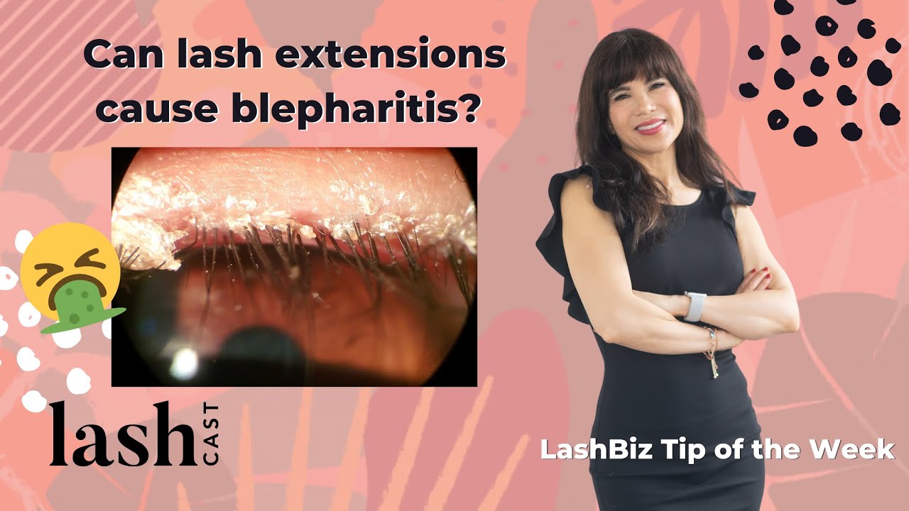 Can lash extensions cause blepharitis? - YouTube