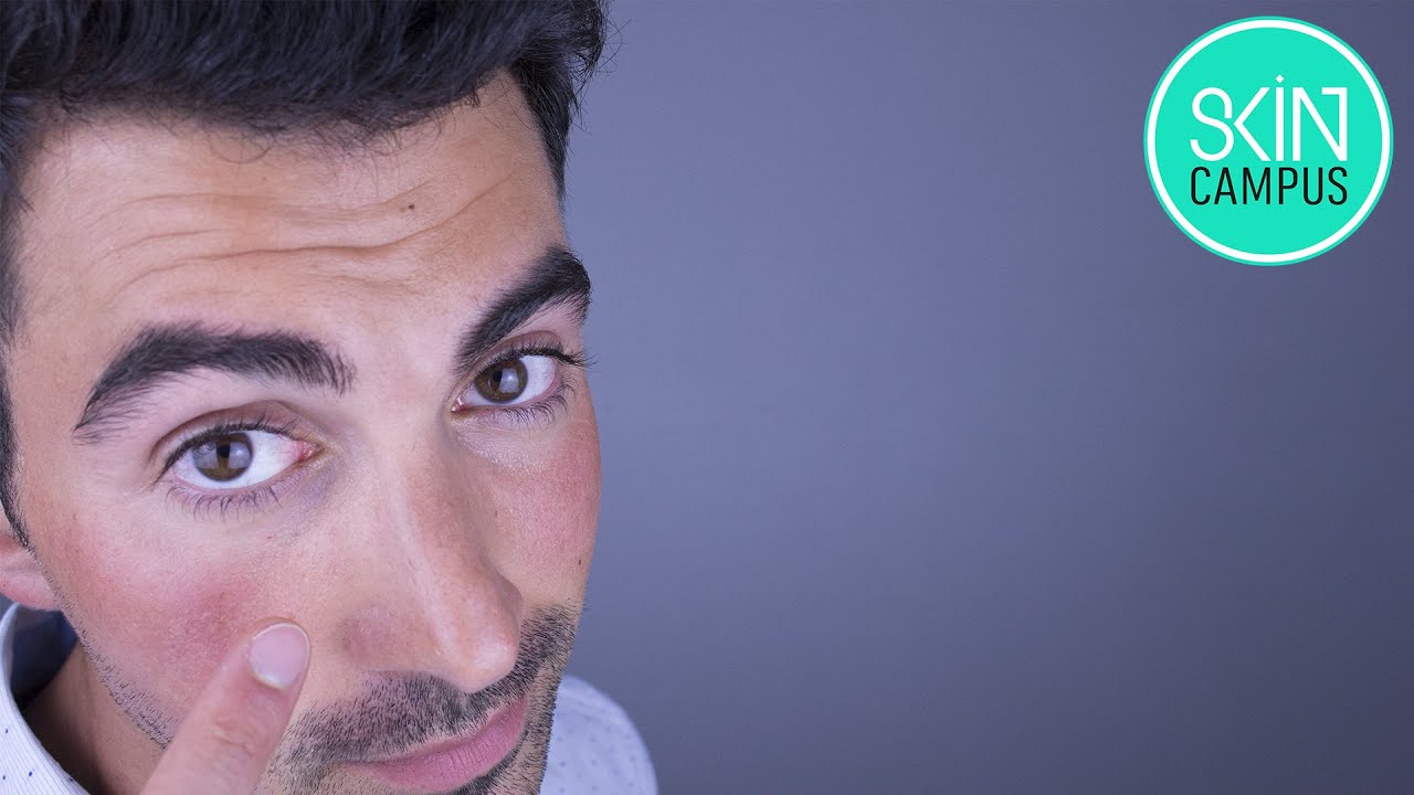 Dermite Séborrhéique - Un Coaching pour s'en Débarrasser à Vie (ce n ...