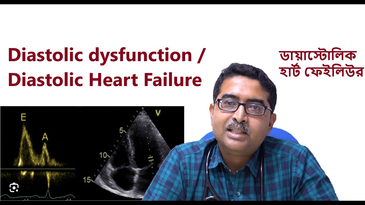 Diastolic dysfunction in Echocardiography / Diastolic Heart Failure ...