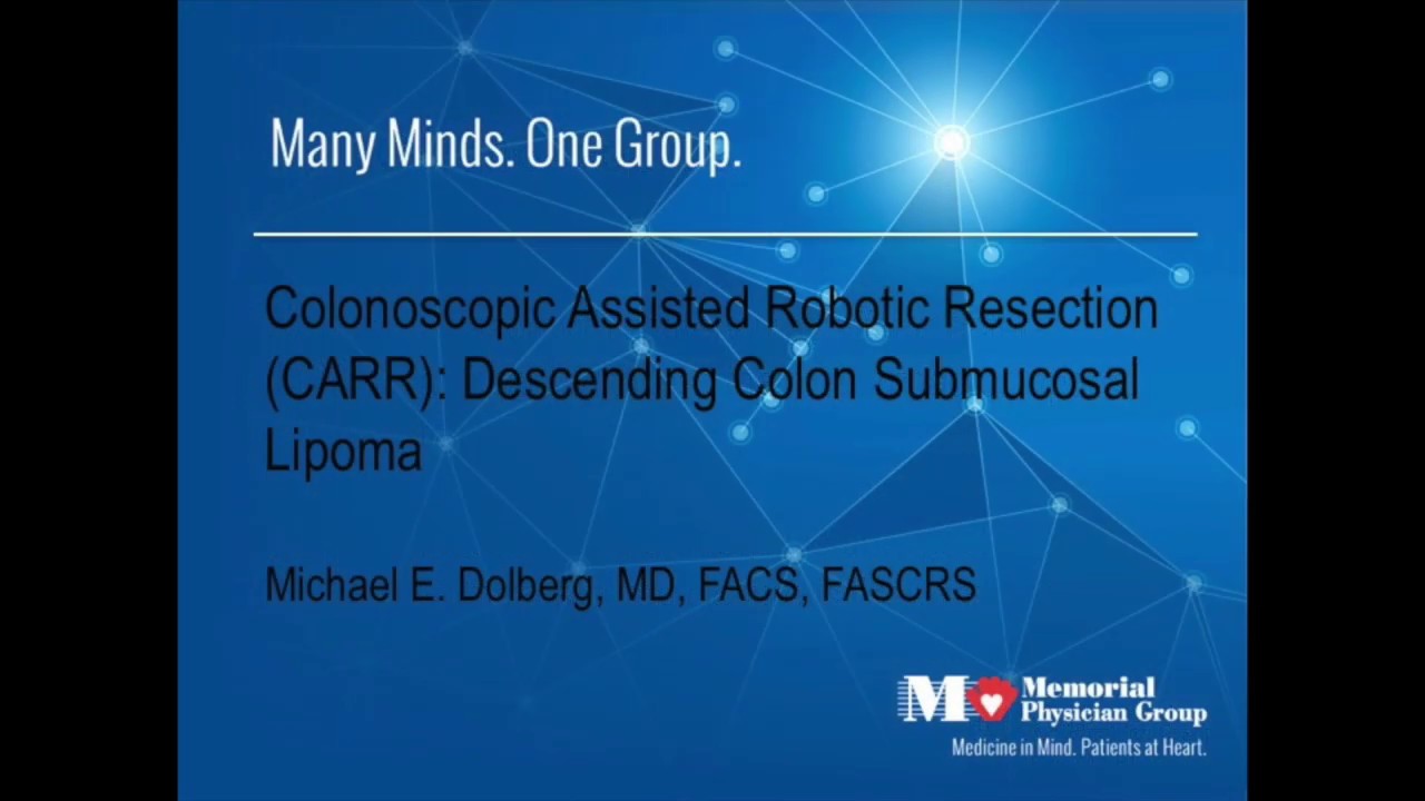 Colonoscopic Assisted Robotic Resection (CARR): Descending Colon ...