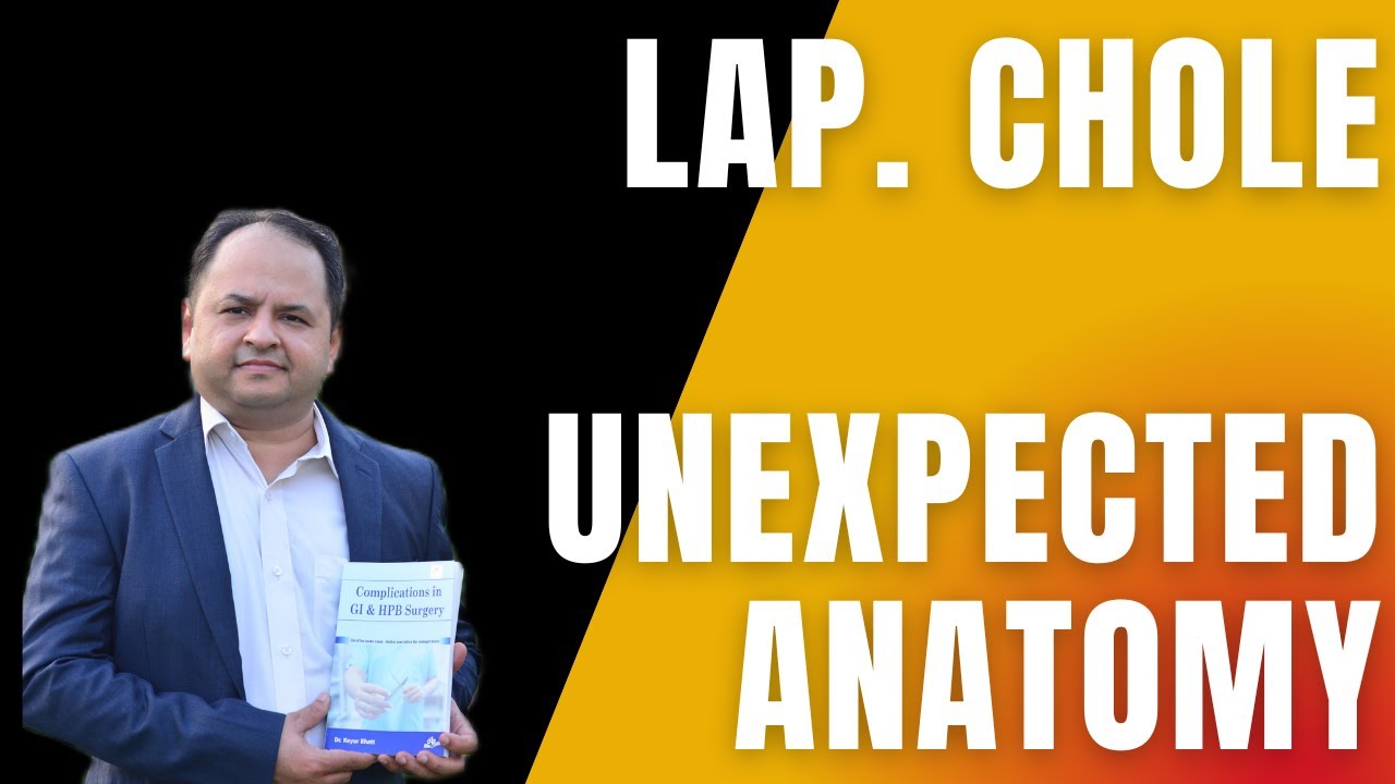 Laparoscopic cholecystectomy | Difficult calot's triangle | Aberrant ...