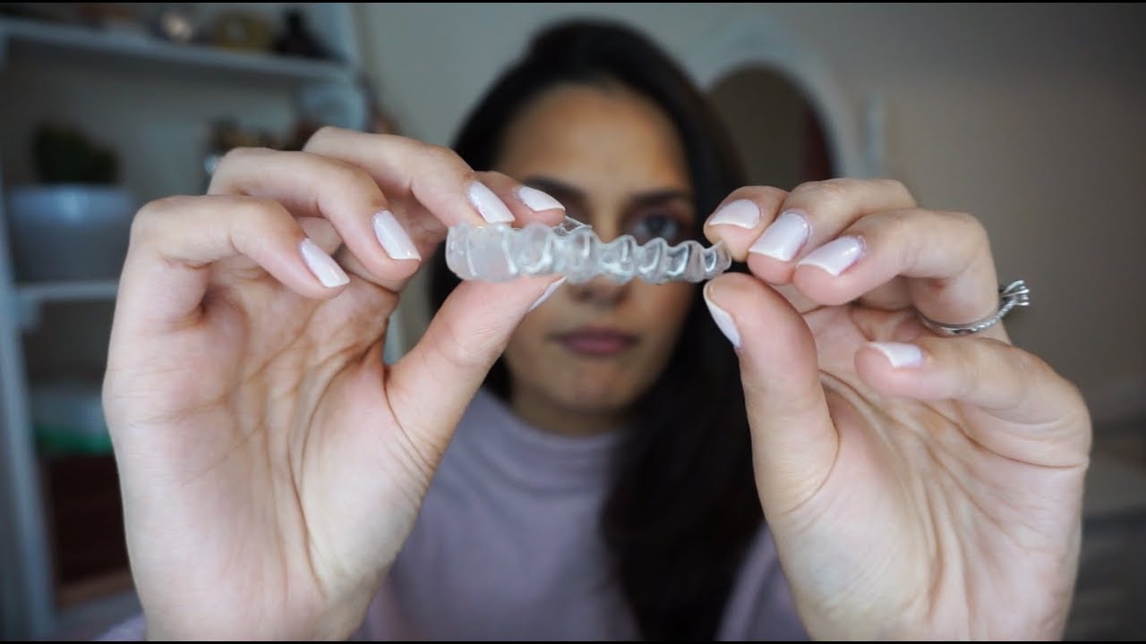MY INVISALIGN JOURNEY #3 Progress so far and applying Tray 2 - YouTube