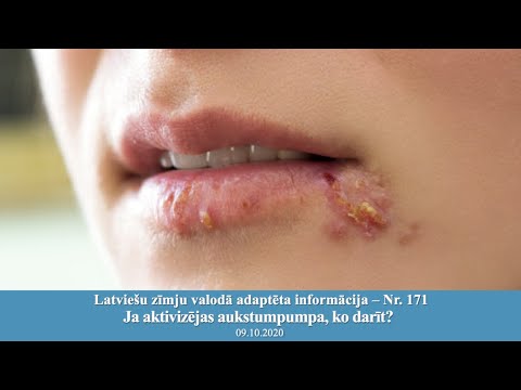 Videoziņas Nr.171 “Ja aktivizējas aukstumpumpa, ko darīt?” - YouTube