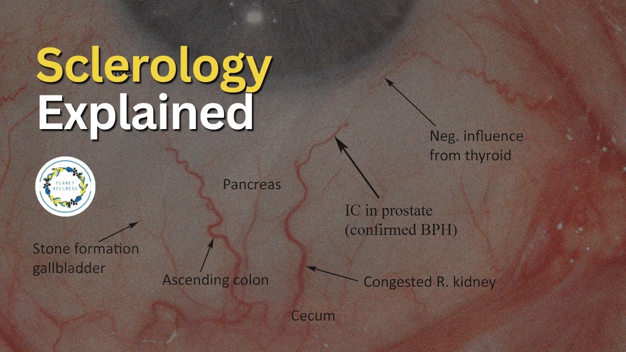 Sclerology Explained - YouTube
